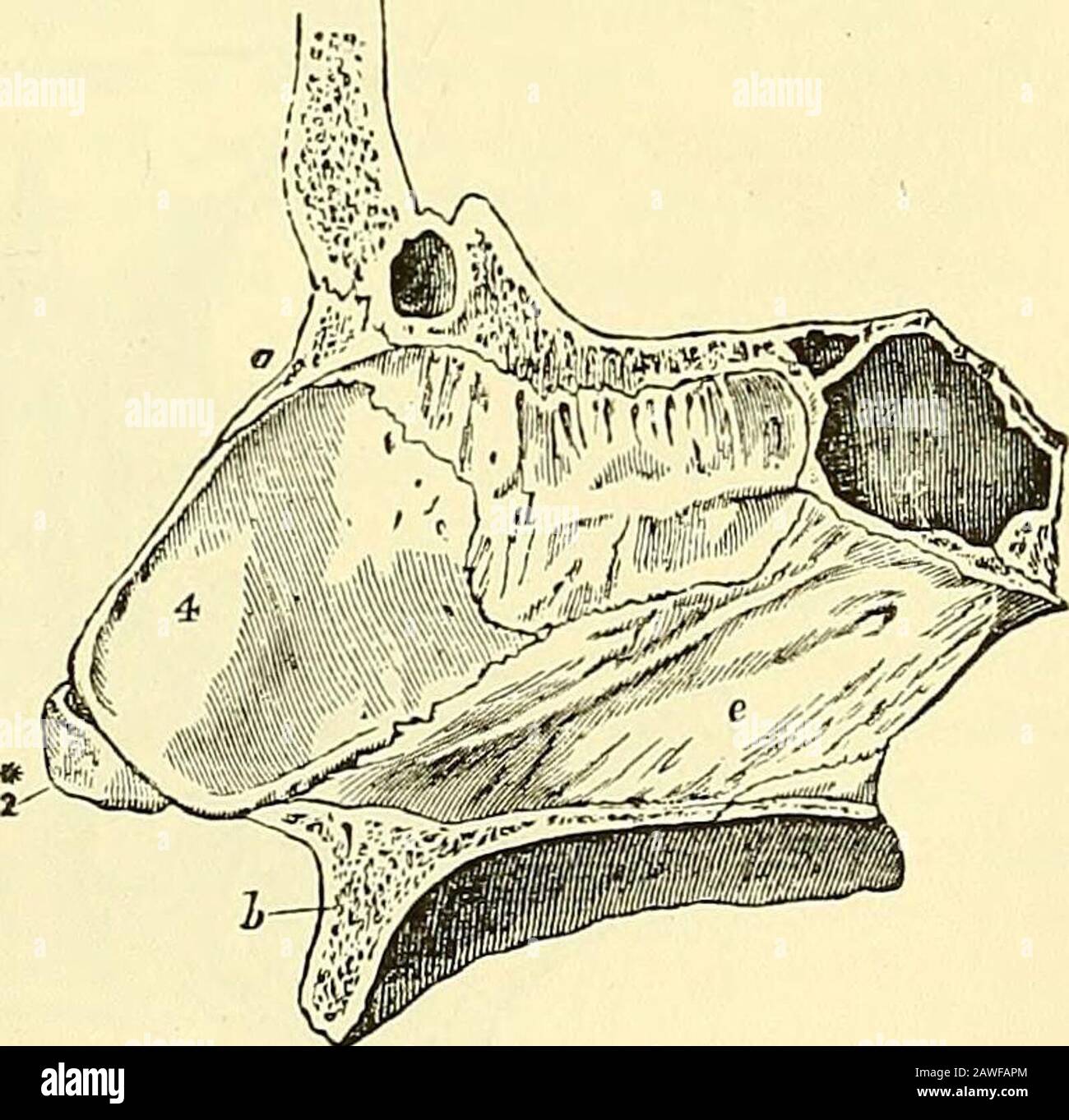 Vomer Perpendicular Plate