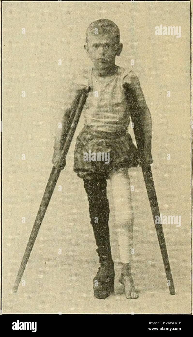 Ear as plaster cast hi-res stock photography and images - Alamy