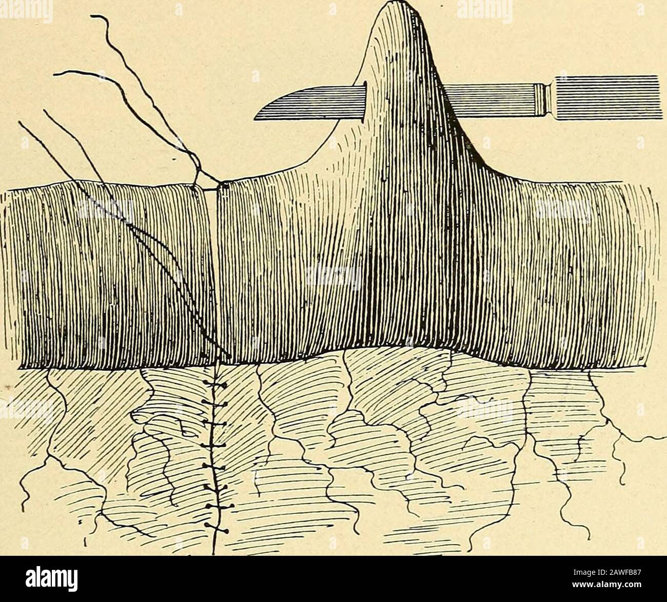 Wounds in war : the mechanism of their production and their treatment ...