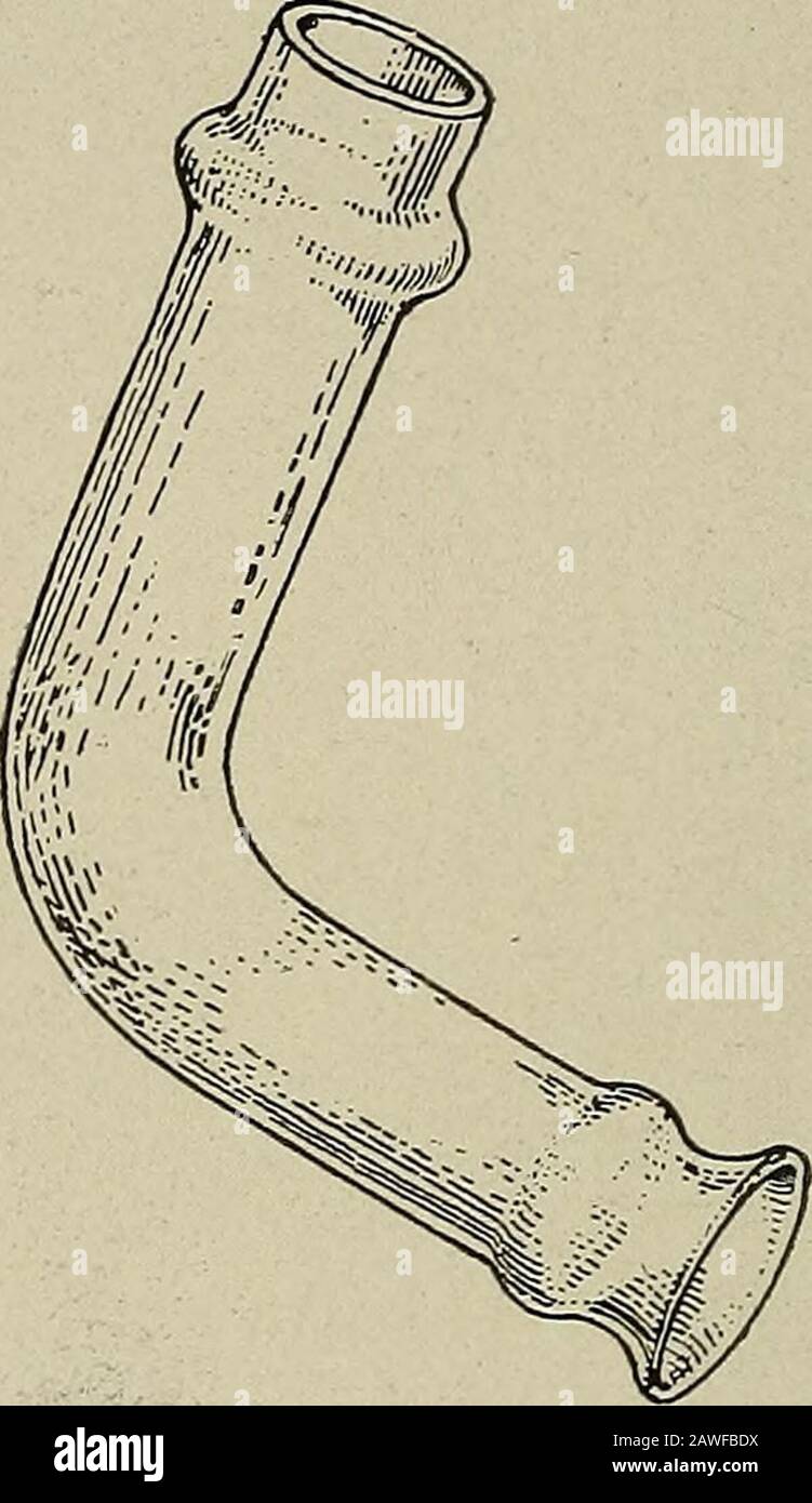 Loop of gut abdomen hi-res stock photography and images - Alamy