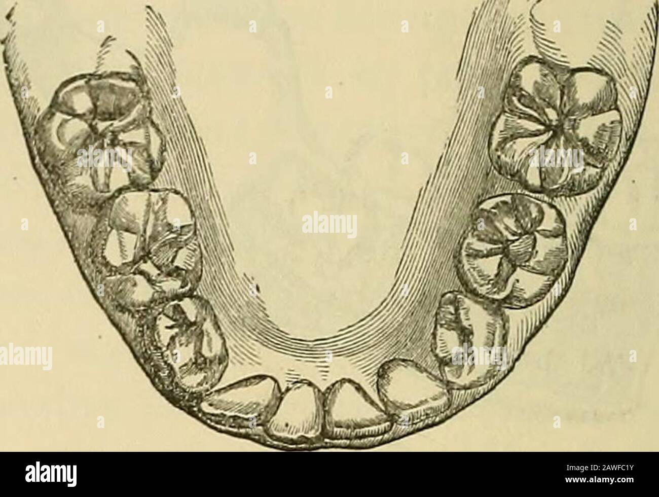 Posterior molars hi-res stock photography and images - Alamy