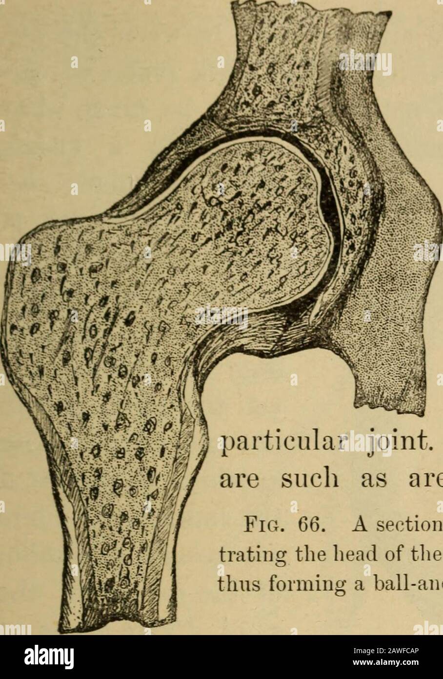 Dislocated joints hi-res stock photography and images - Alamy