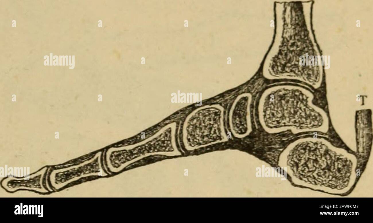 Foot anatomy bones side view hi-res stock photography and images - Alamy