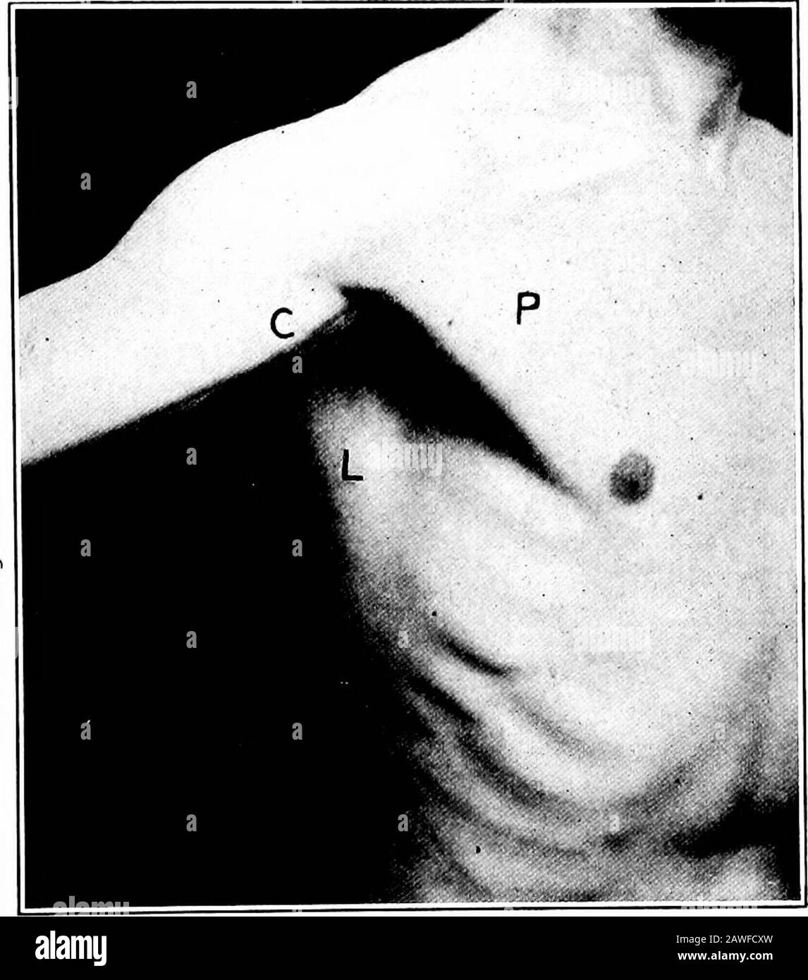 Applied anatomy and kinesiology, the mechanism of muscular movement ...