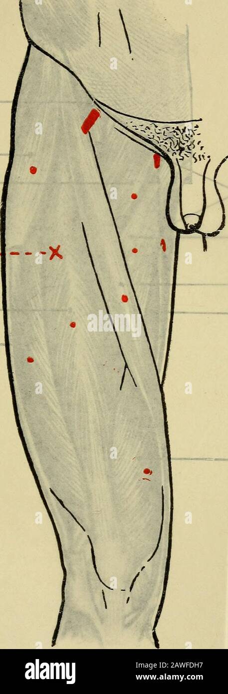 Deep muscles of leg hi-res stock photography and images - Alamy