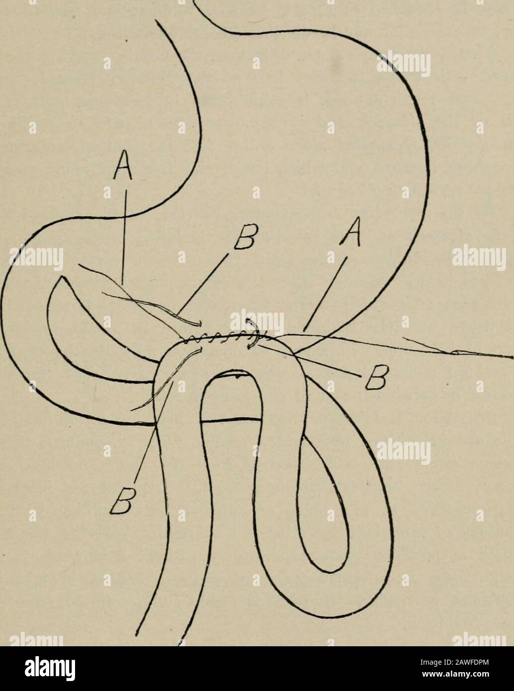 Thepoint hi-res stock photography and images - Alamy