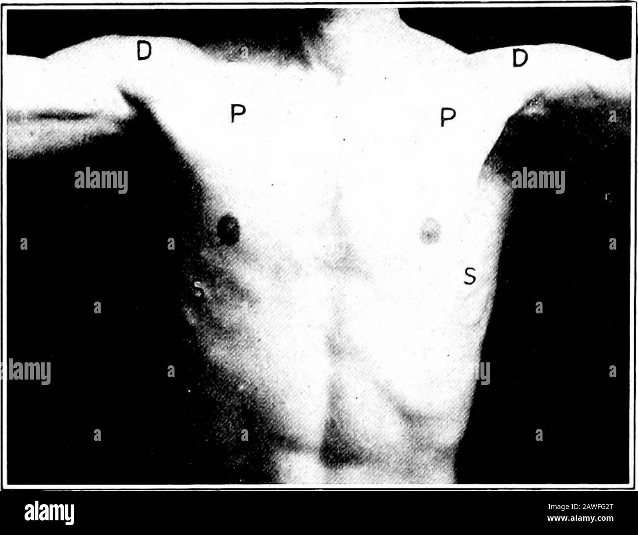 Movements of shoulder joint hi-res stock photography and images - Alamy