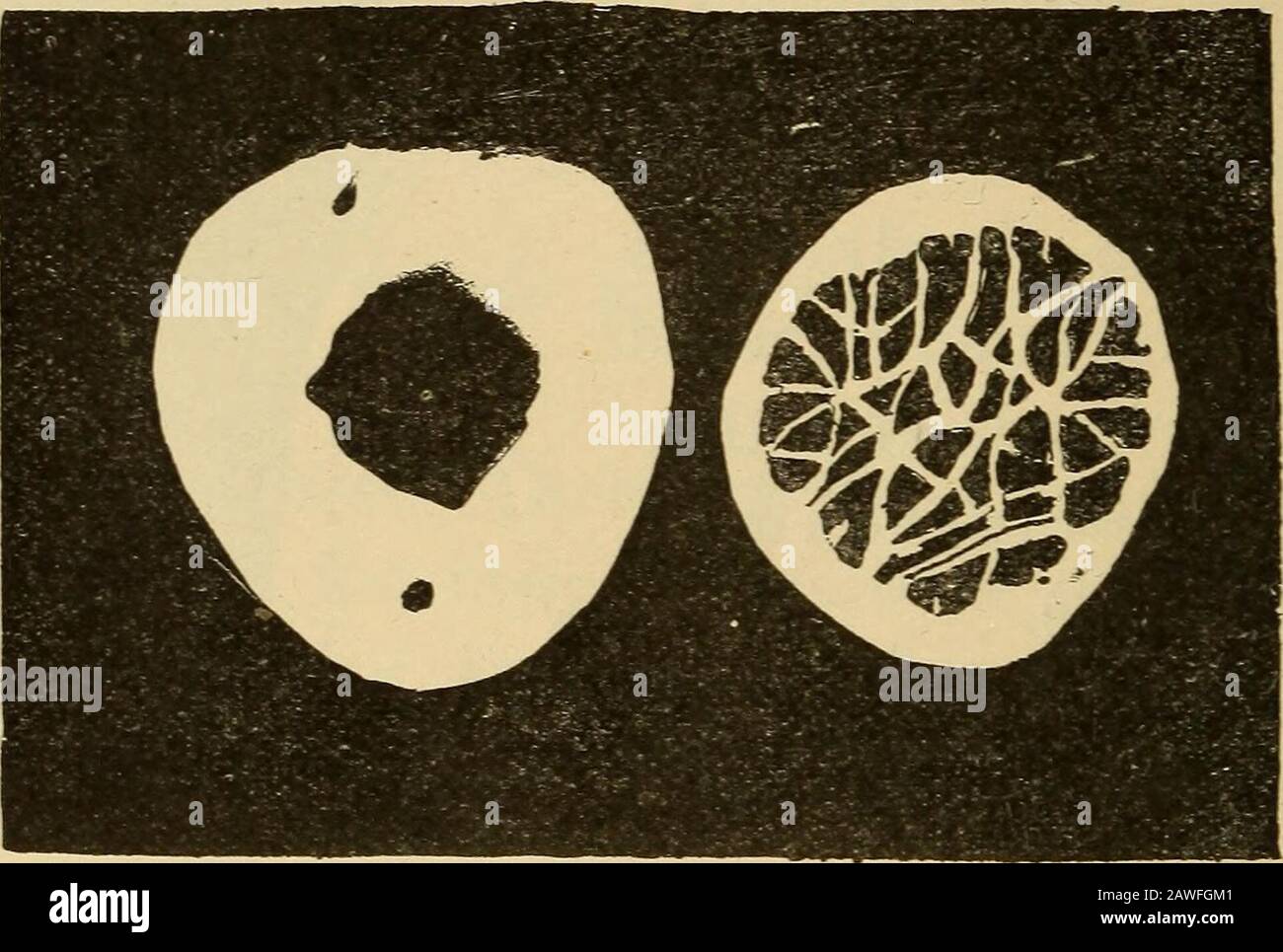 Longitudinal section of bone hi-res stock photography and images - Alamy