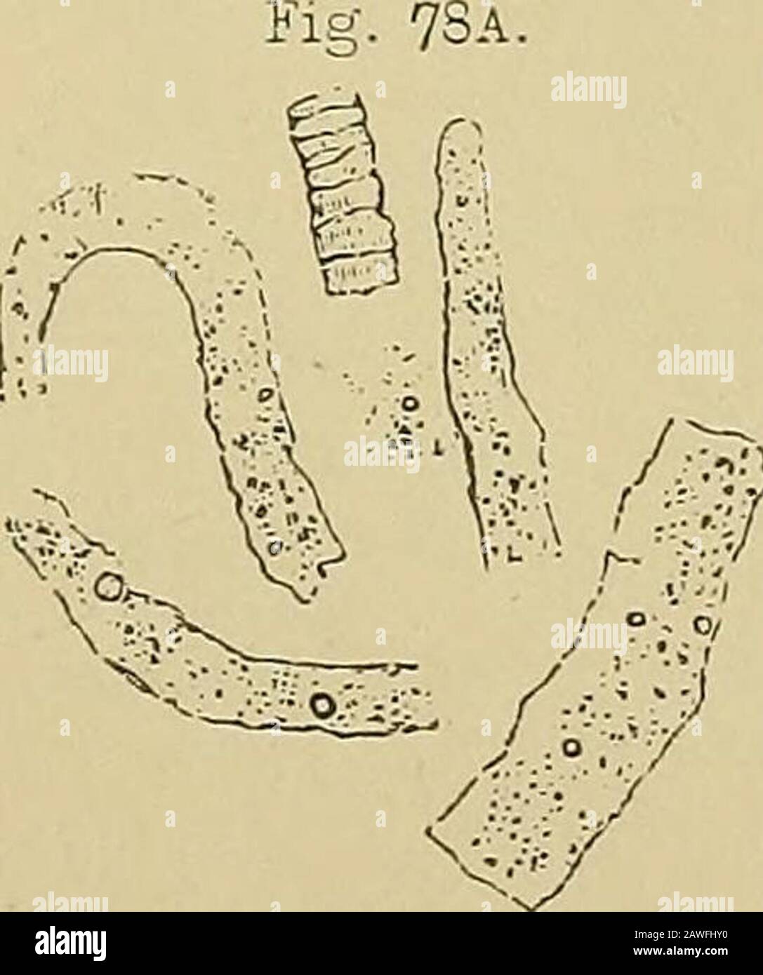 Kidney diseases, urinary deposits, and calculous disorders : their ...