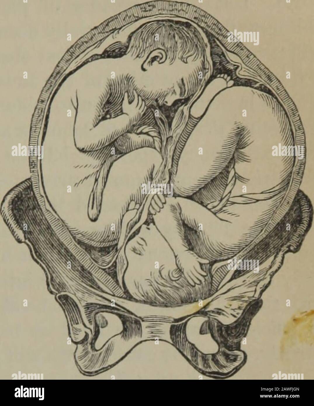 Fetus in utero hi-res stock photography and images - Alamy