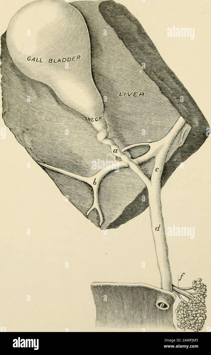 Operative surgery . dder.—The gall bladdei-is fre(|uently operated on ...