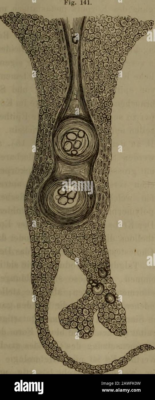 Epitheliom hi-res stock photography and images - Alamy