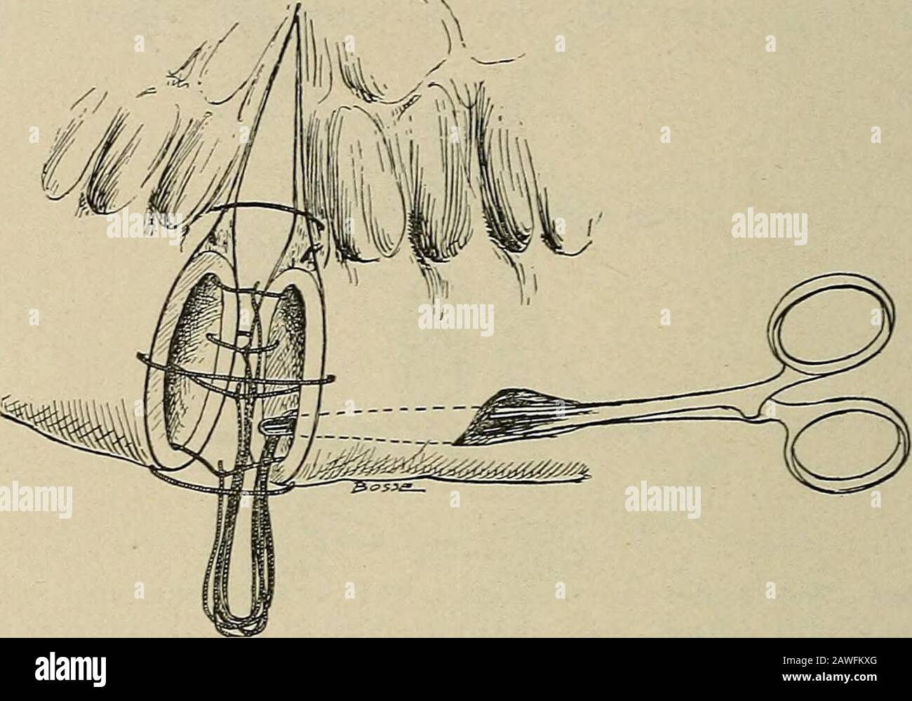 Gut knot hi-res stock photography and images - Alamy