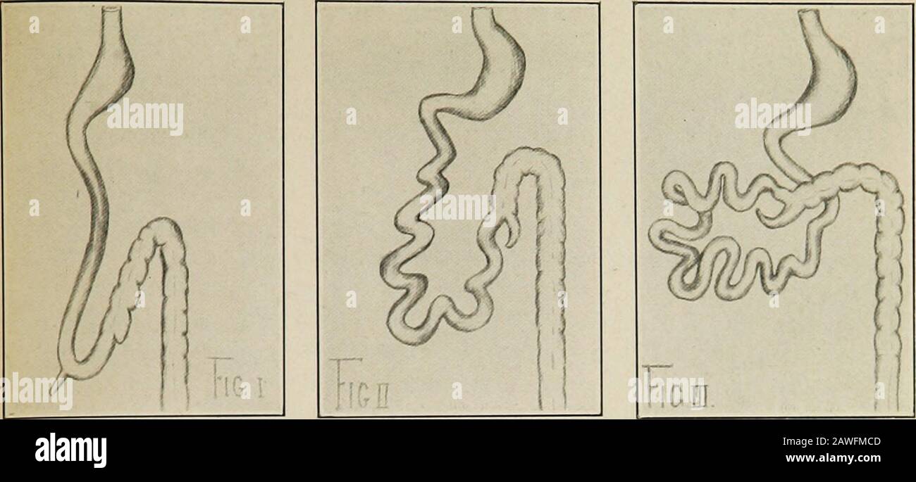 Cephalic position hi-res stock photography and images - Alamy