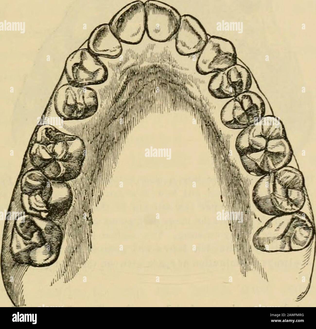 Lower Dental Arch