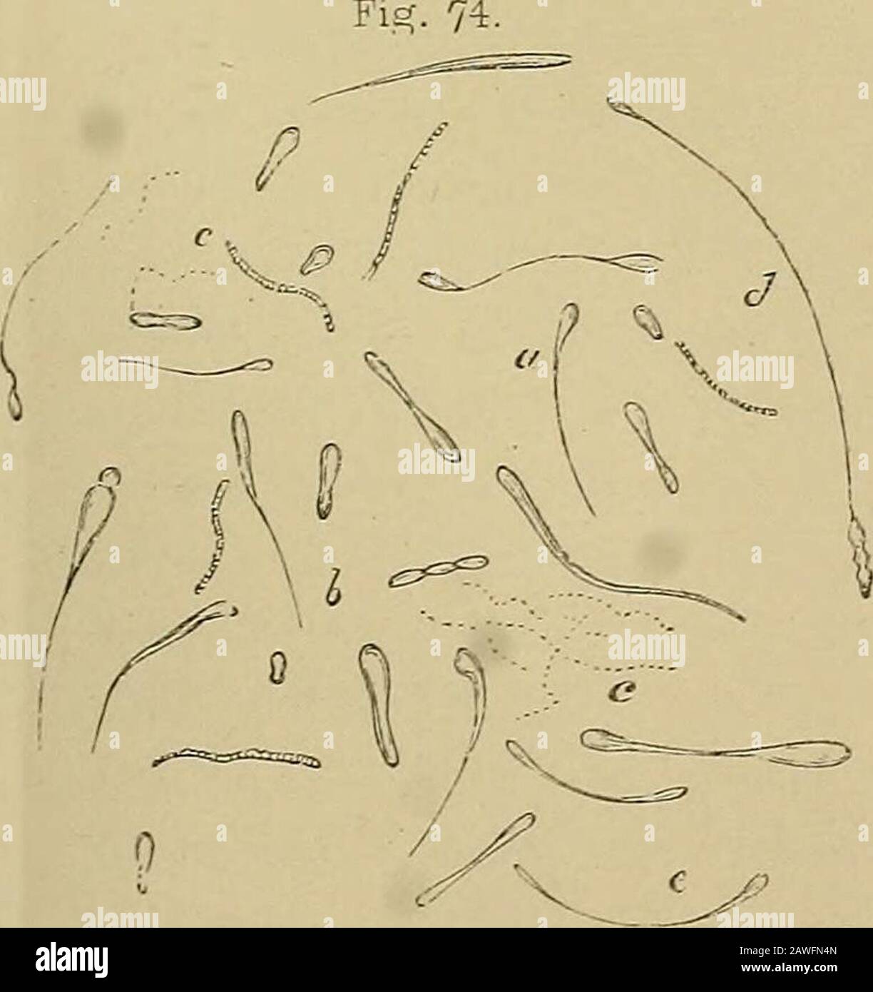 Kidney diseases, urinary deposits, and calculous disorders : their ...