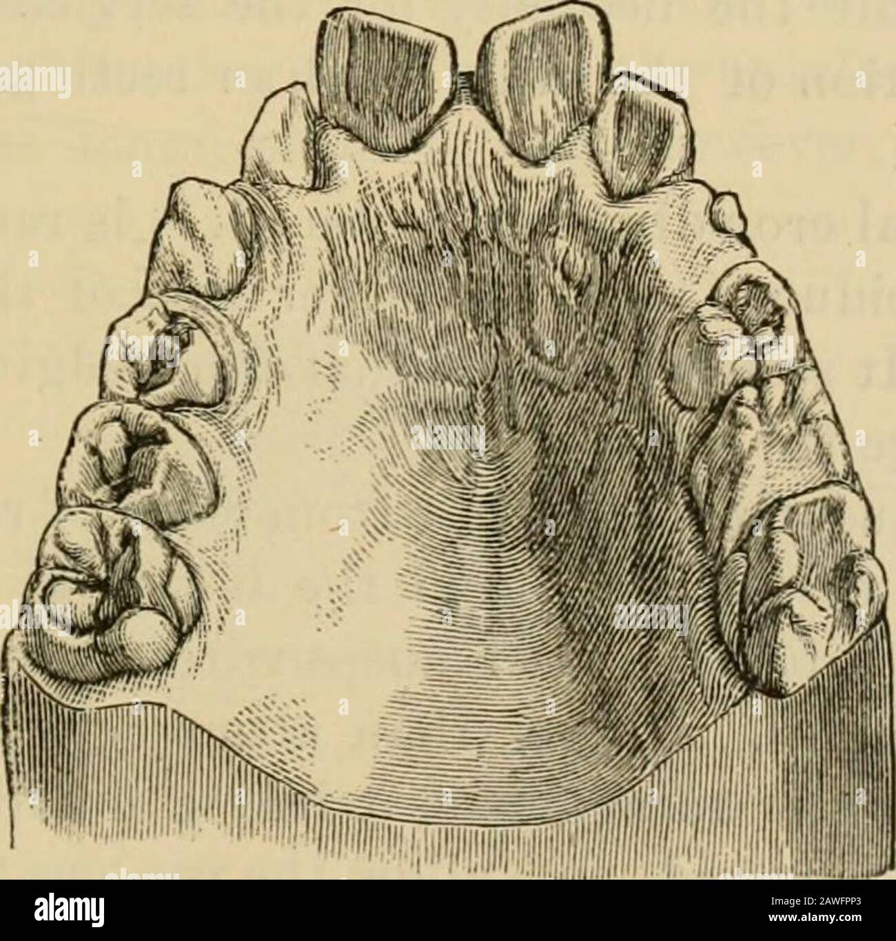 Slightly inward bent ends hi-res stock photography and images - Alamy