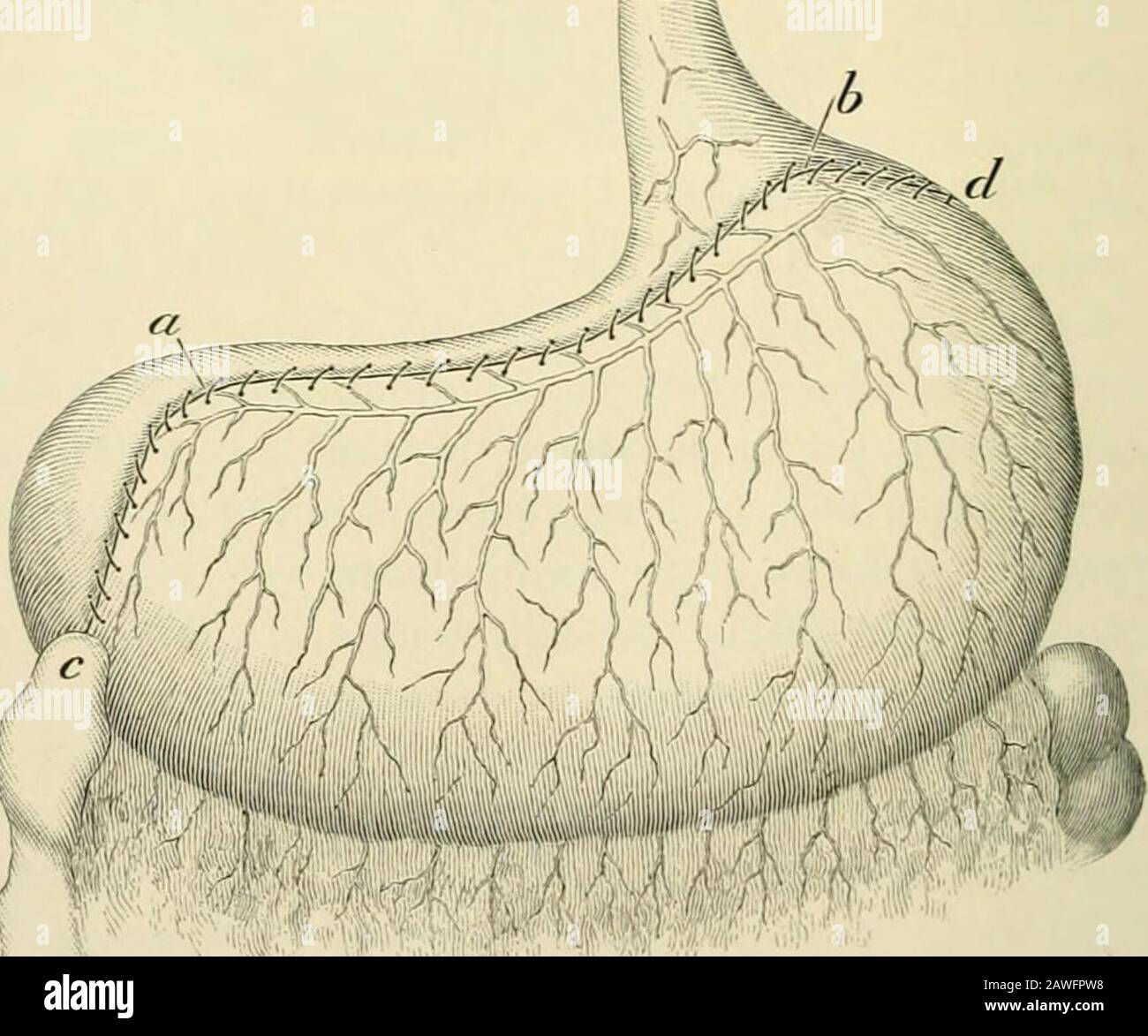 Operative surgery . cases with 3 deaths.Gastroplicatioii.—The operation ...