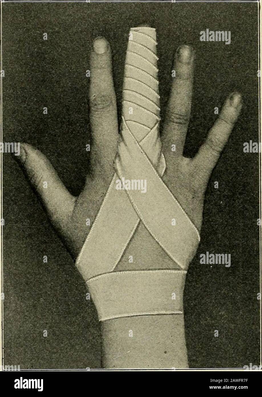 Fowlers second hi-res stock photography and images - Alamy