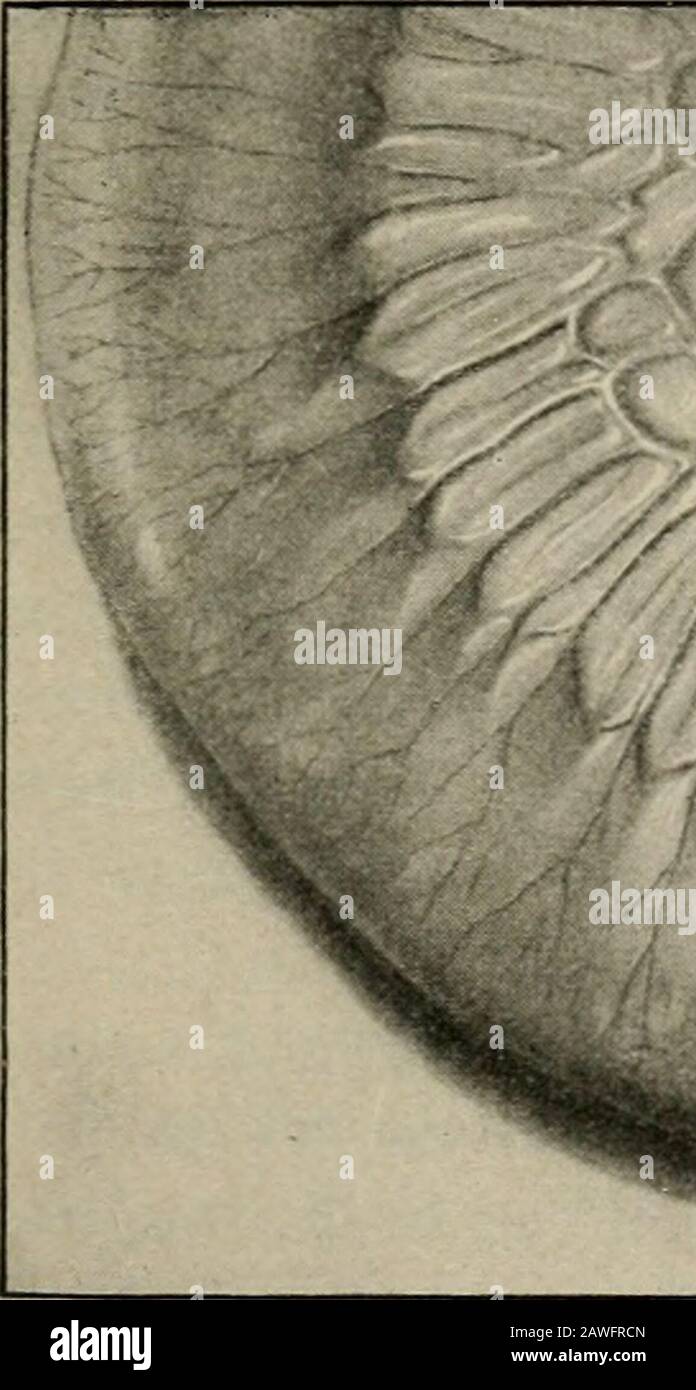 Operative surgery, for students and practitioners . Fig. 188.—Section ...