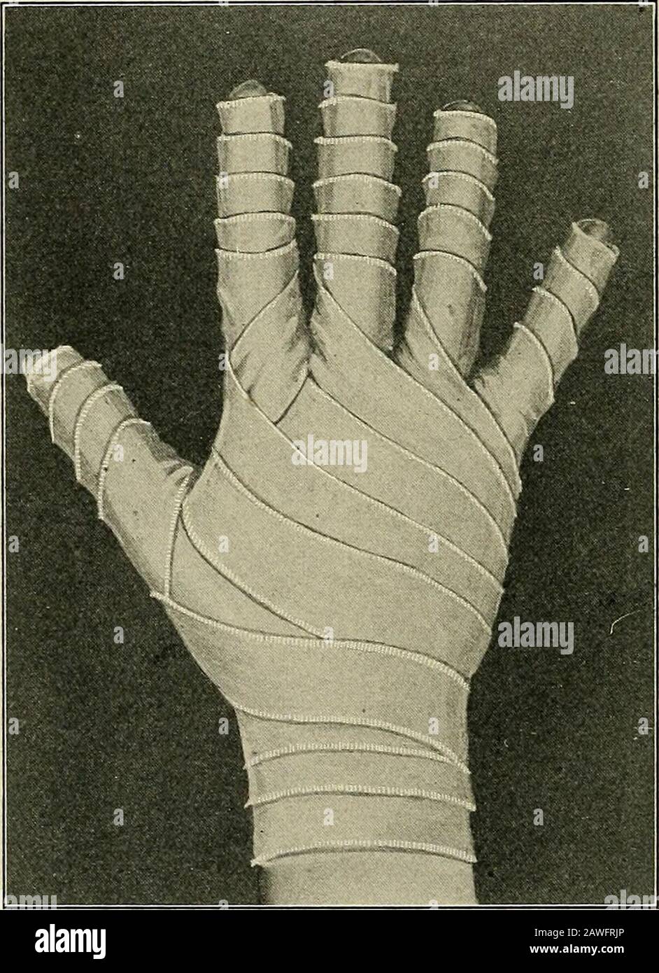 Spiral bandage hi-res stock photography and images - Alamy