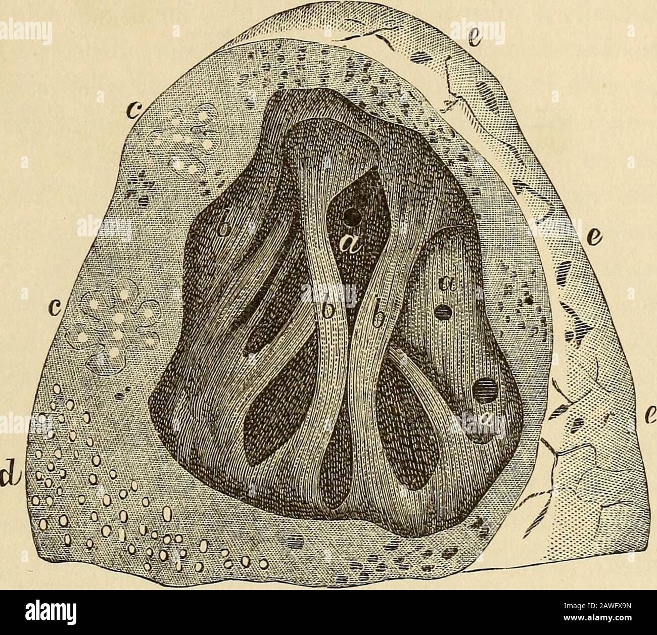 Early early stage tuberculosis hi-res stock photography and images - Alamy