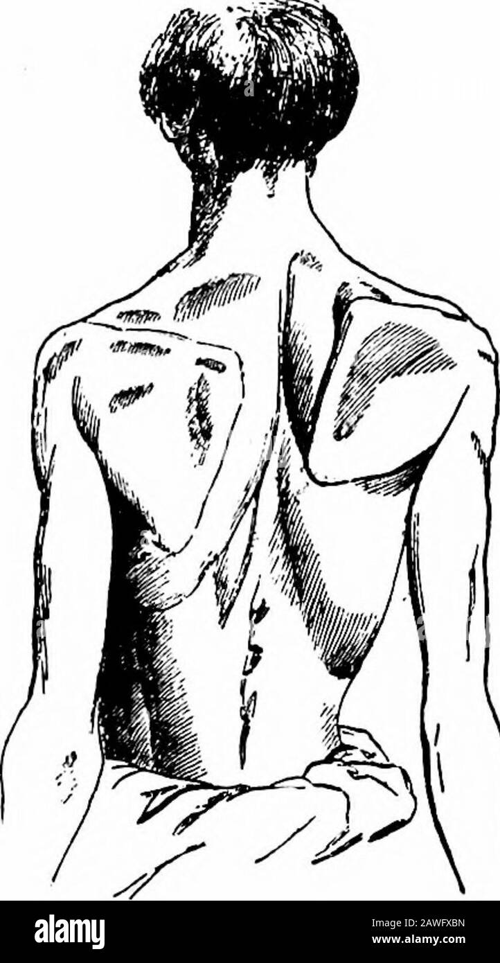 Shoulder adduction Black and White Stock Photos & Images - Alamy