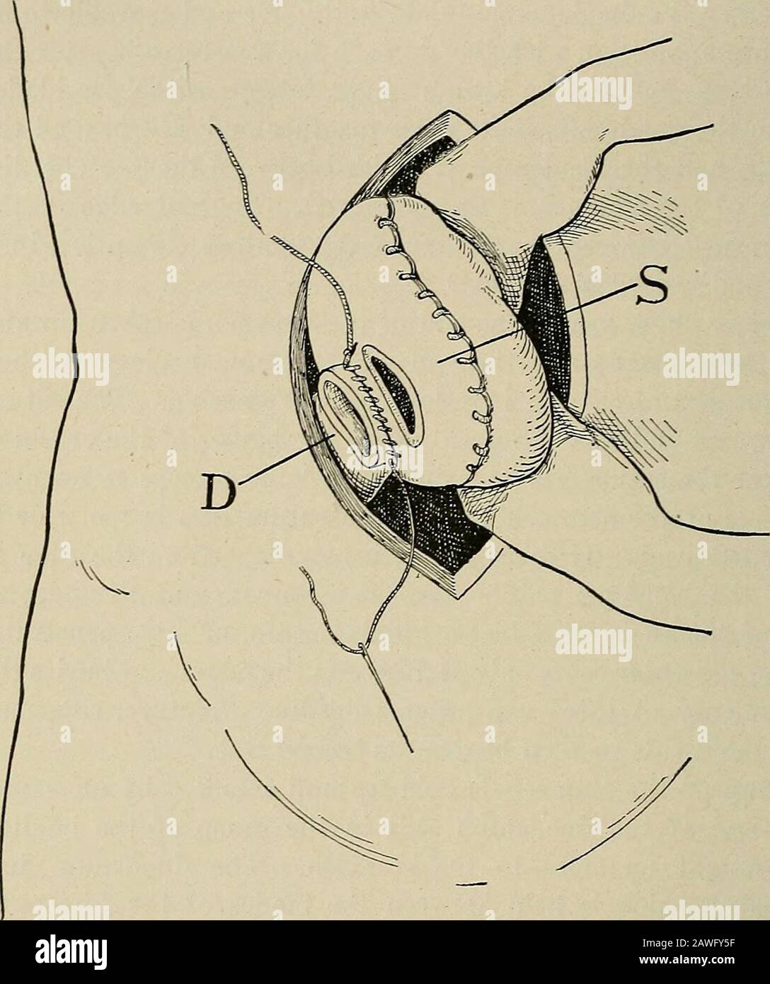 Two Line Circumference High Resolution Stock Photography and Images - Alamy