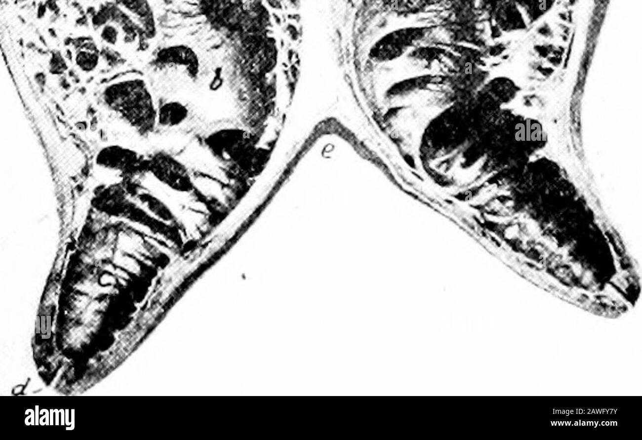 Upper body cross section hi-res stock photography and images - Alamy