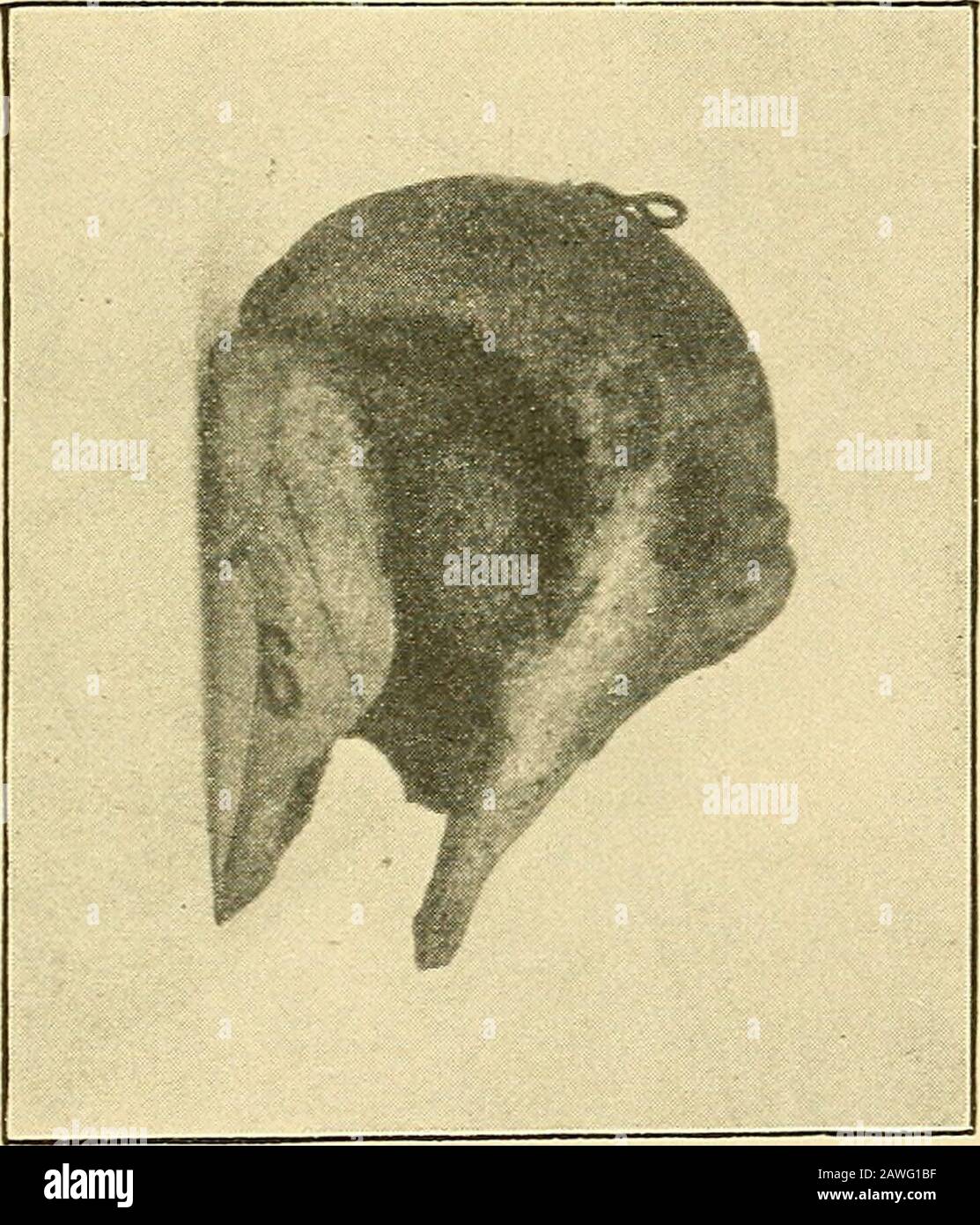 Wounds in war : the mechanism of their production and their treatment ...