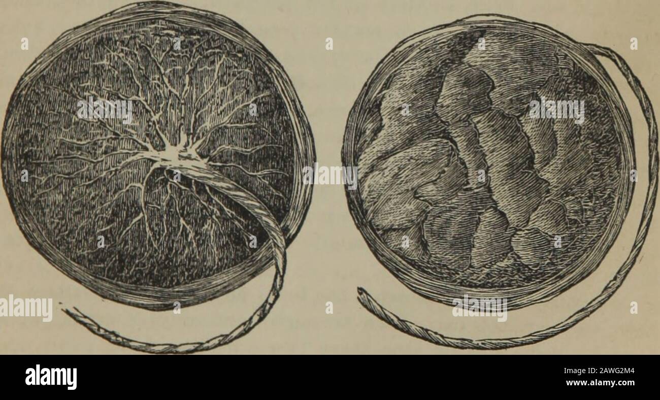Fallopius hi-res stock photography and images - Alamy
