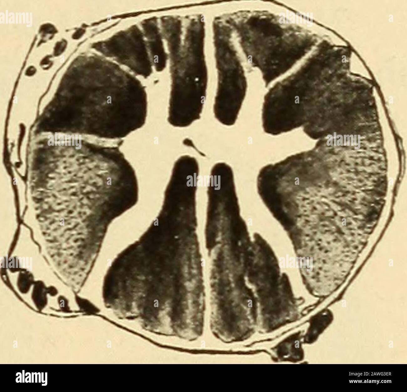 Motorneuron hi-res stock photography and images - Alamy