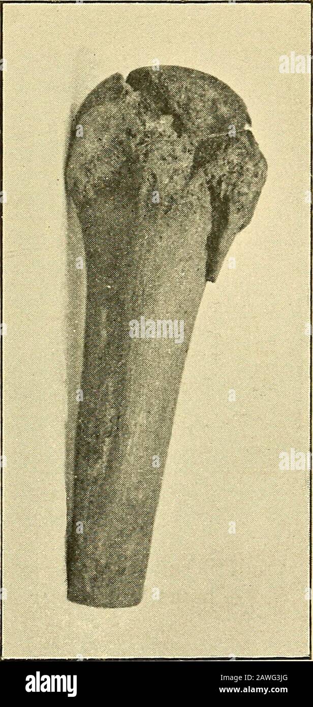 Degree of comminution hi-res stock photography and images - Alamy