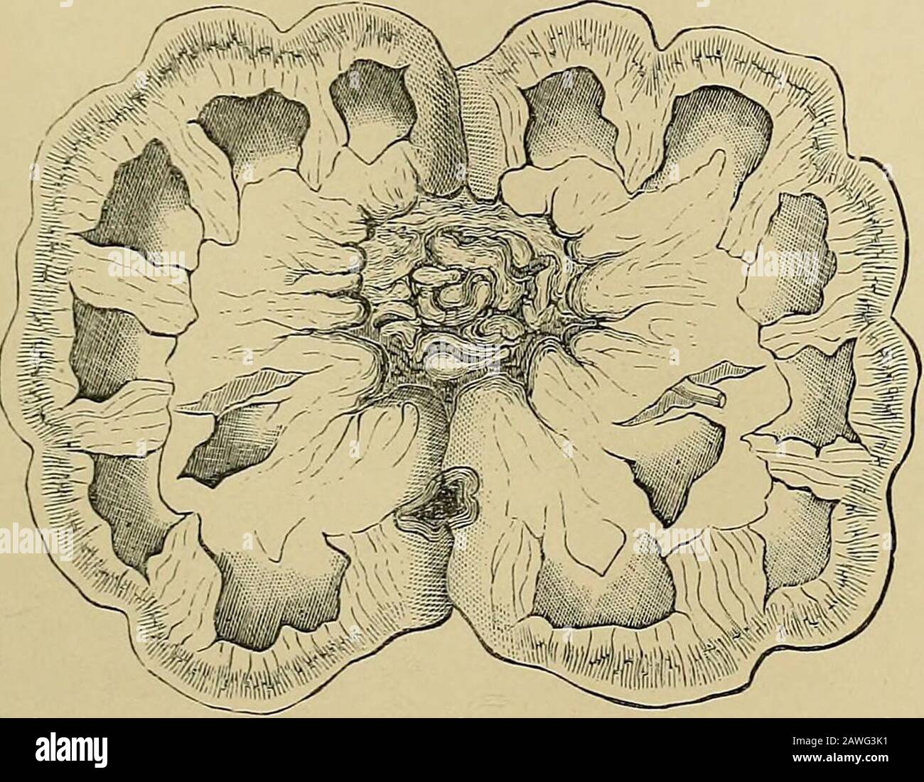 Kidney diseases, urinary deposits, and calculous disorders : their ...