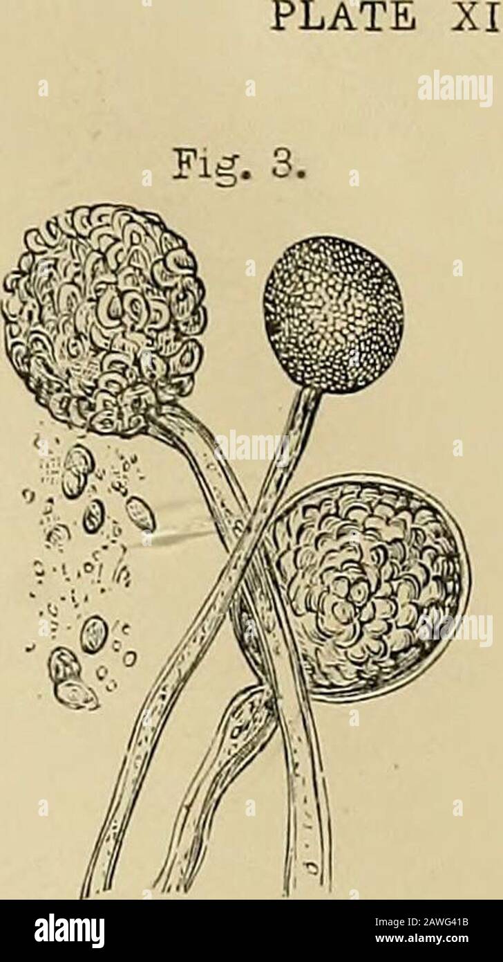 Kidney diseases, urinary deposits, and calculous disorders : their ...