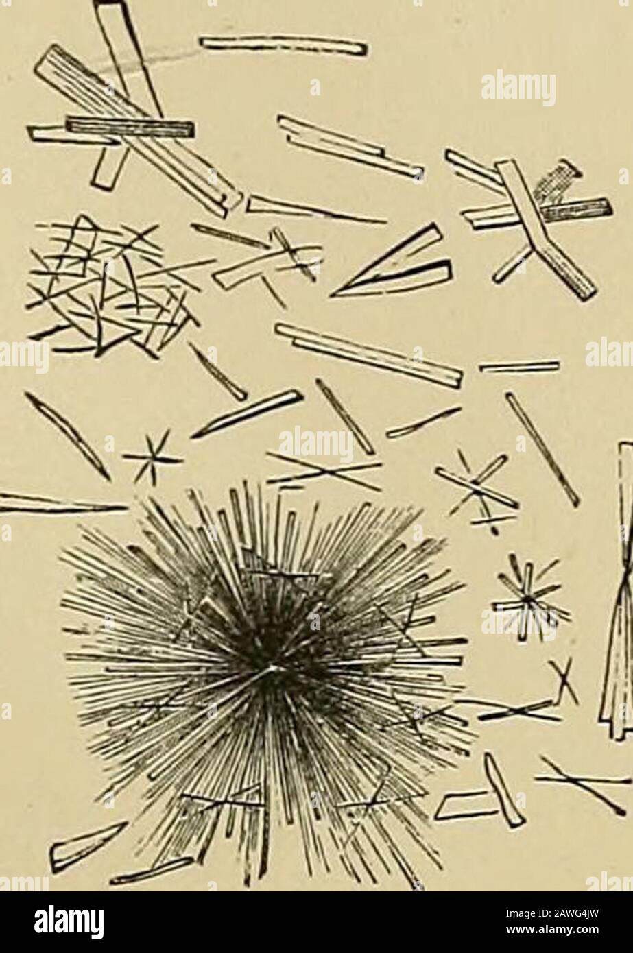 Kidney diseases, urinary deposits, and calculous disorders : their ...