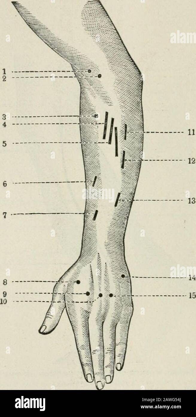 Posterior aspect of forearm hi-res stock photography and images - Alamy
