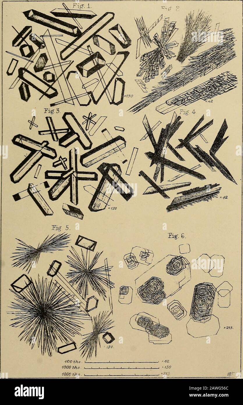 Kidney diseases, urinary deposits, and calculous disorders : their ...