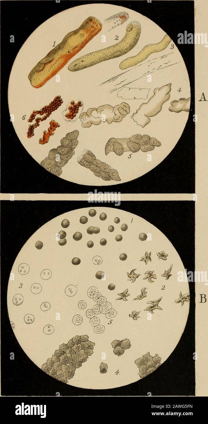 Analysis of the urine . PLATE VI.—A. 1. Cystine: the powder of a ...