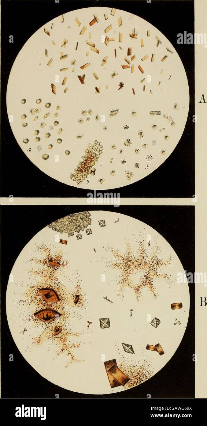 Analysis of the urine . PLATE IV.—A.Leucine and tyrosine: sediment from ...