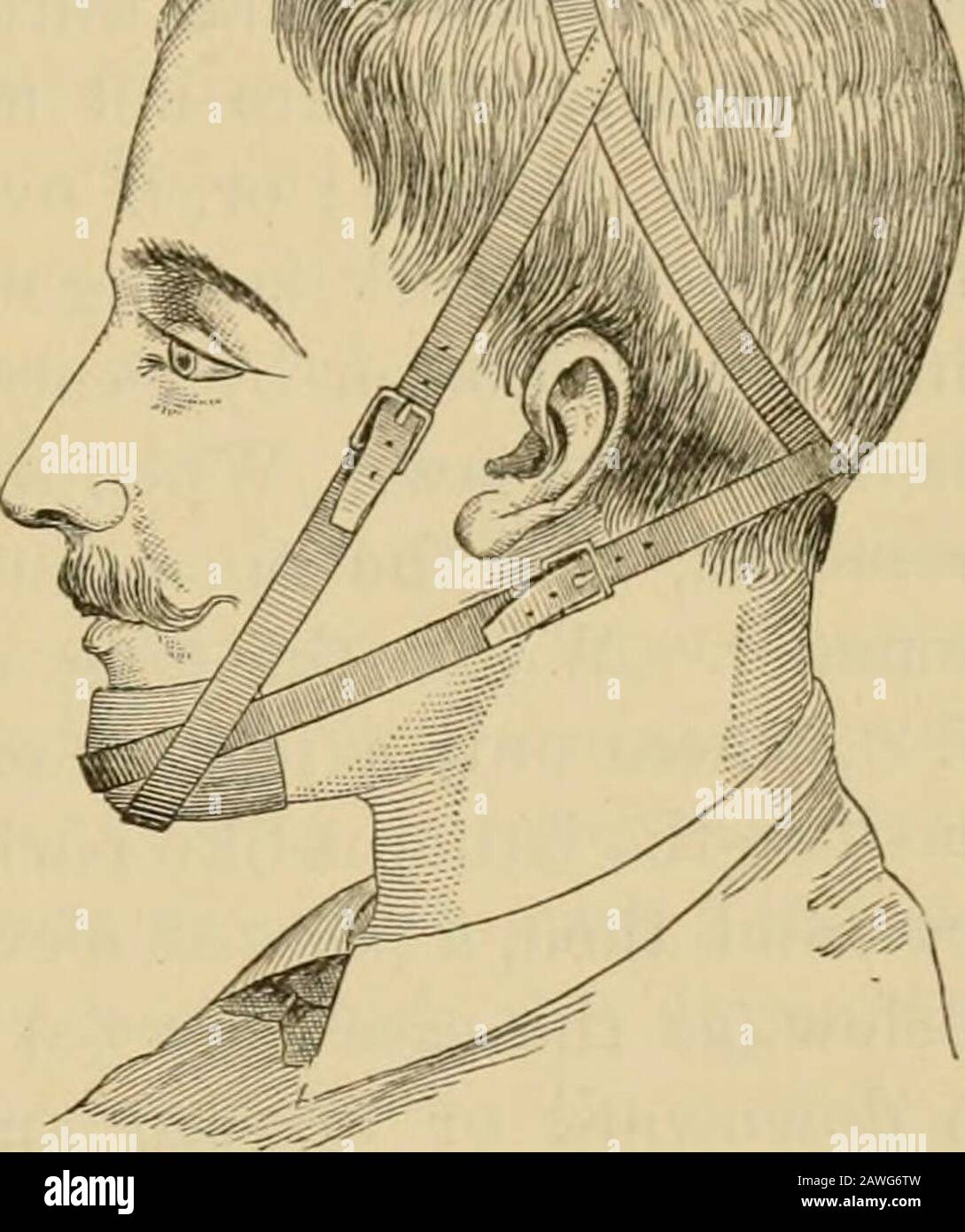 Chin retractor hi-res stock photography and images - Alamy