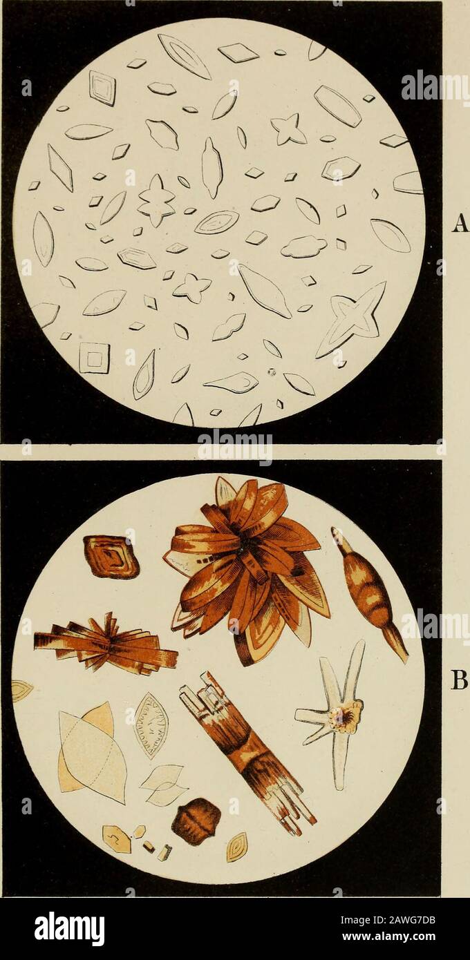 Analysis of the urine . PLATE I.—A. 1, Epithelium from the straight ...