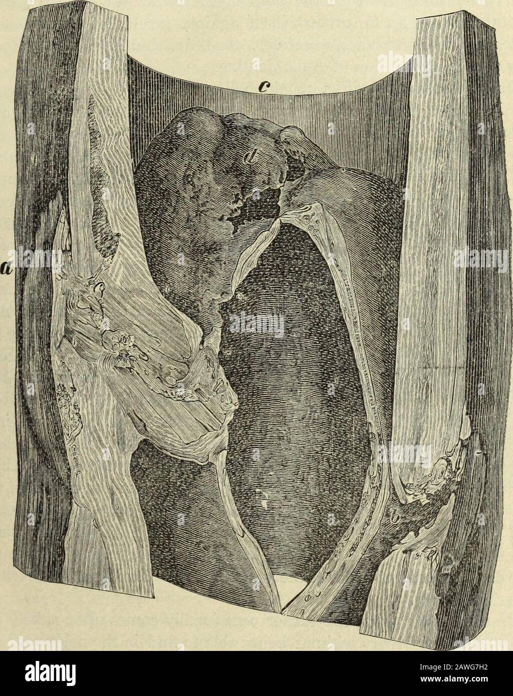 The Dental cosmos . Fig. 35.—Cross-section from the alveolar portion of ...
