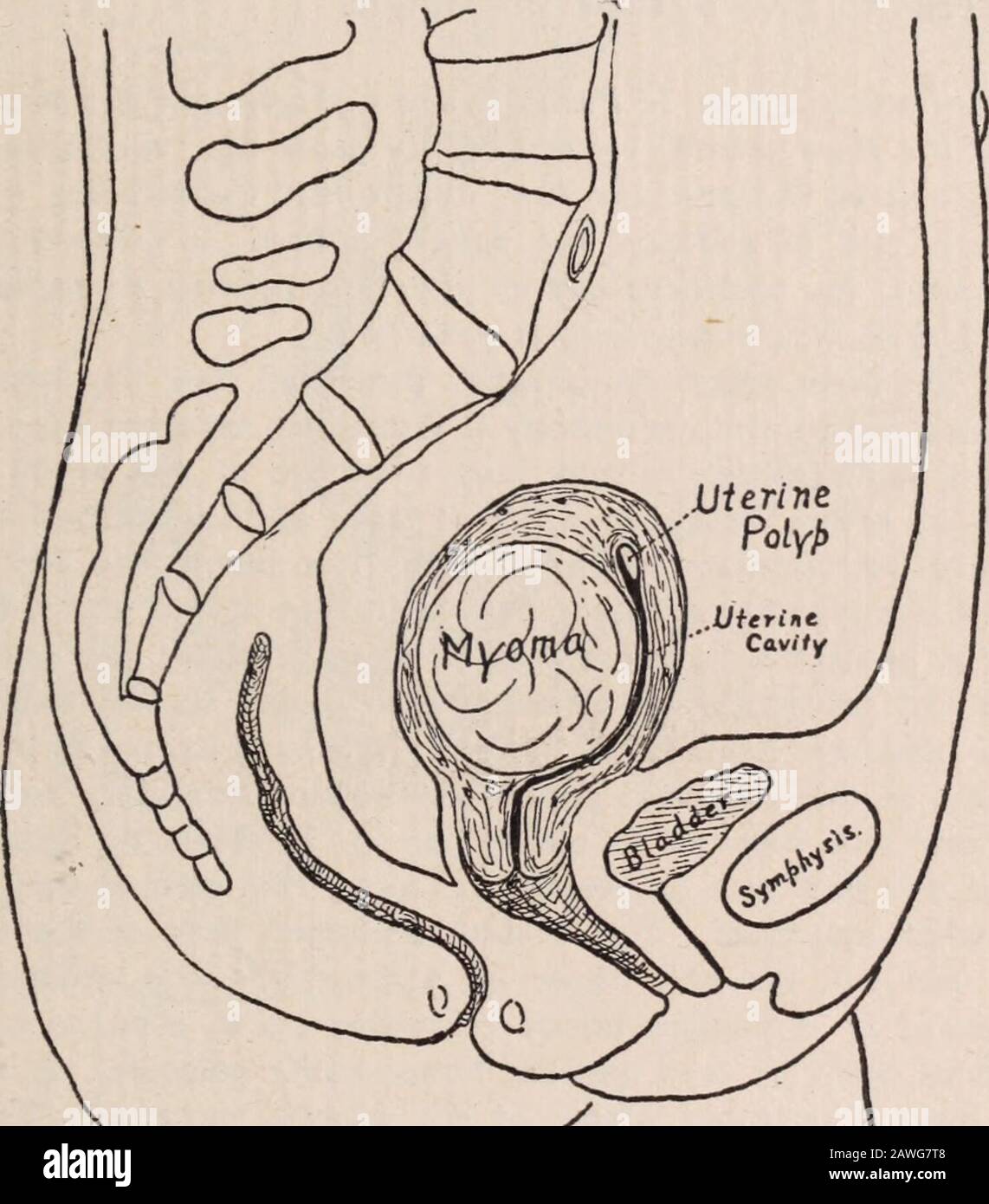 3 5 x enlargement hi-res stock photography and images - Alamy