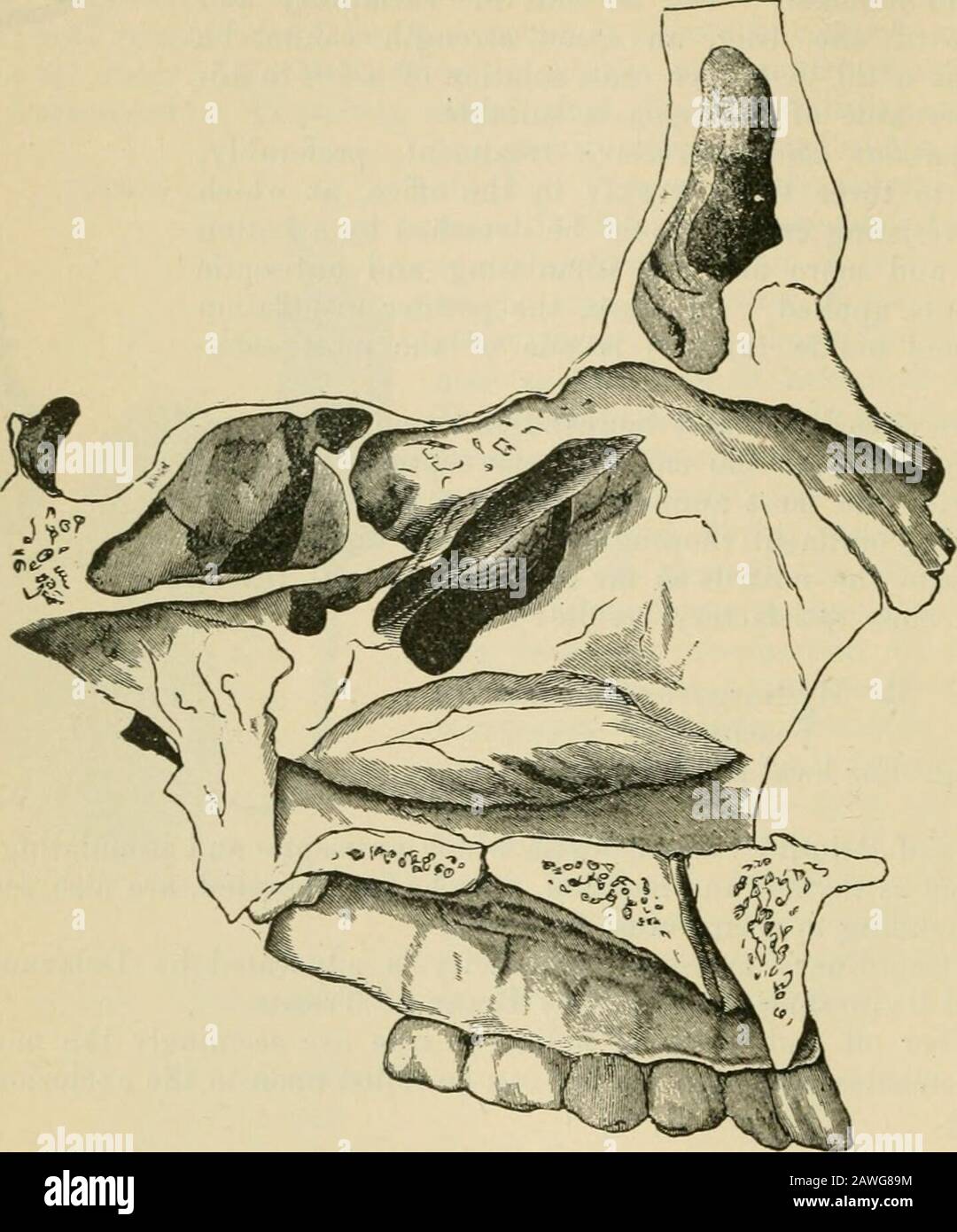 Polypi hi-res stock photography and images - Alamy