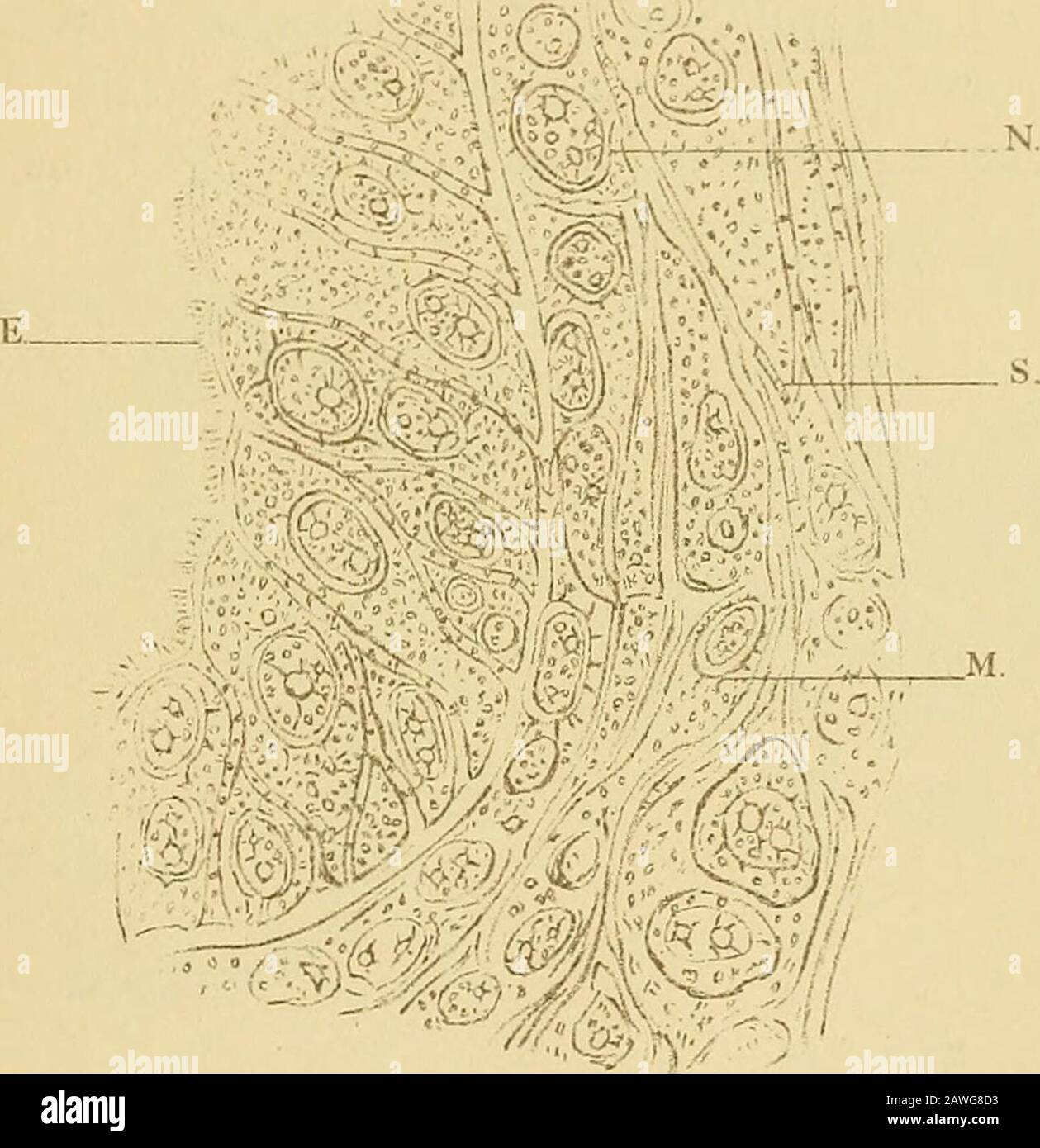 The causes and treatment of abortion . ering to the fundal portion of ...