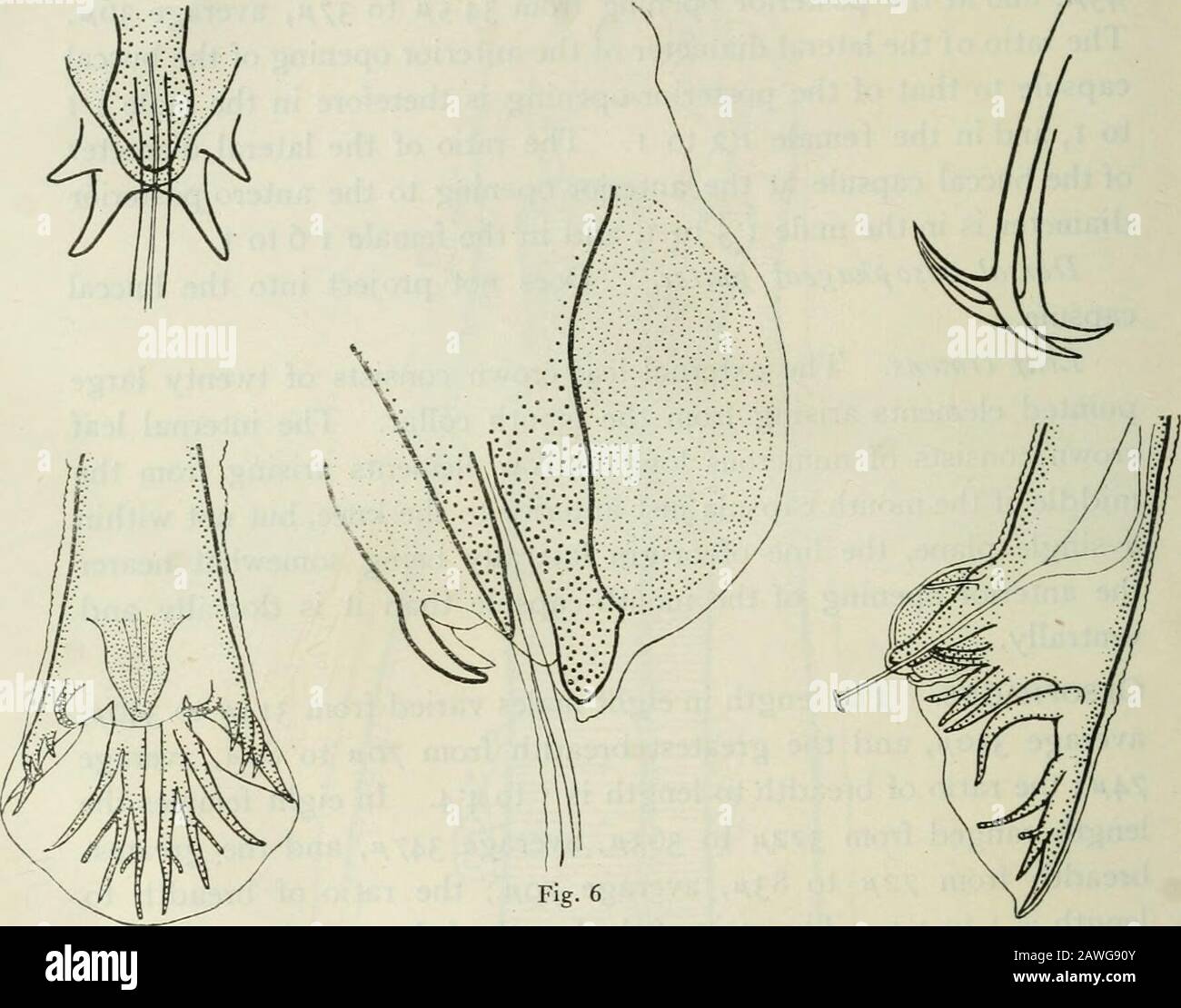Cervical ring hi-res stock photography and images - Alamy