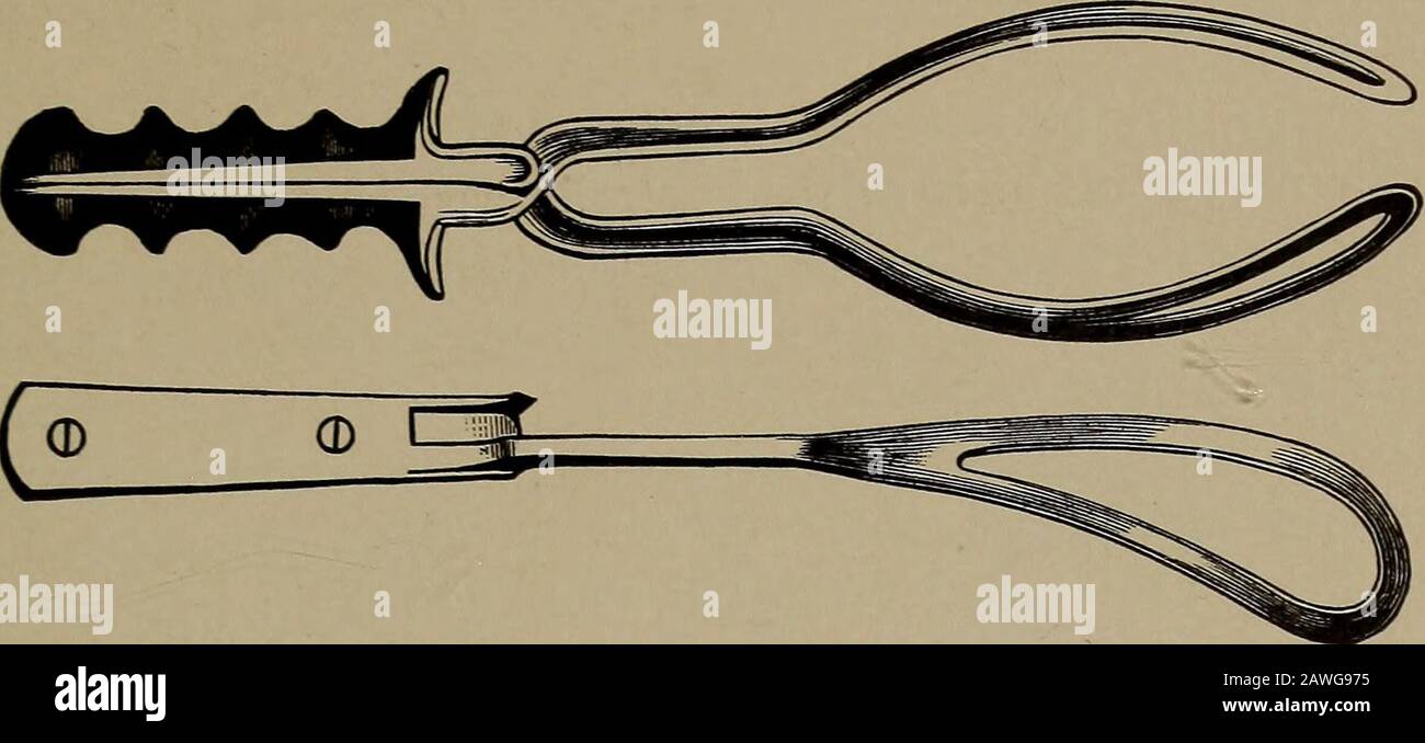 Axis traction forceps hi-res stock photography and images - Alamy