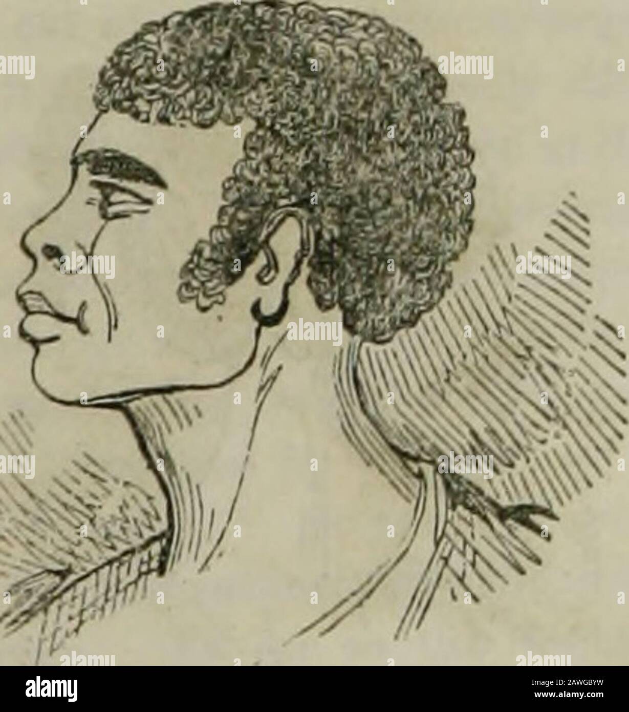 Chin That Sticks Out