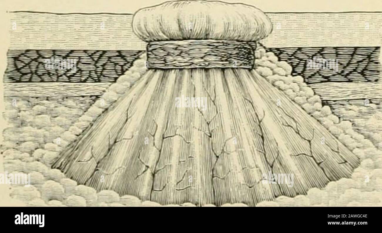 Operative surgery . Fig. 953. Fig. 954. Fig. 953.—Senns method of ...